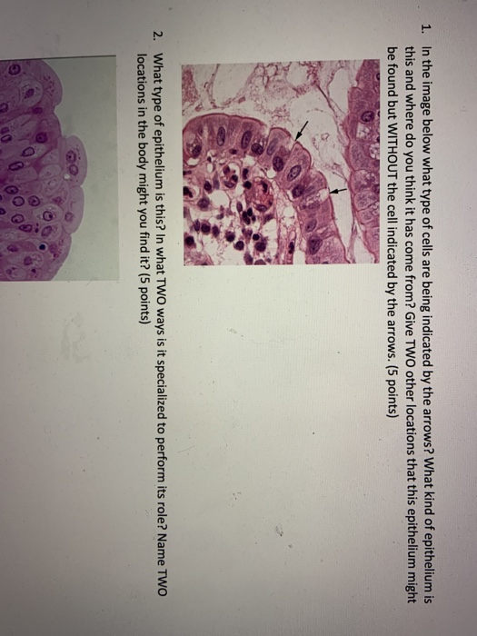 Solved 1. In the image below what type of cells are being | Chegg.com
