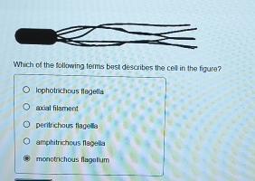 Solved Which of the following terms best describes the cell | Chegg.com