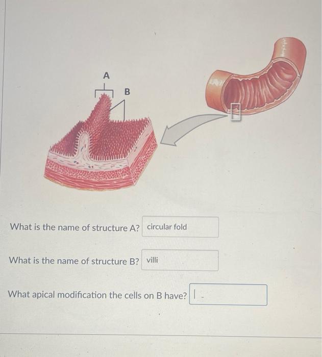 Solved A B What is the name of structure A? circular fold | Chegg.com