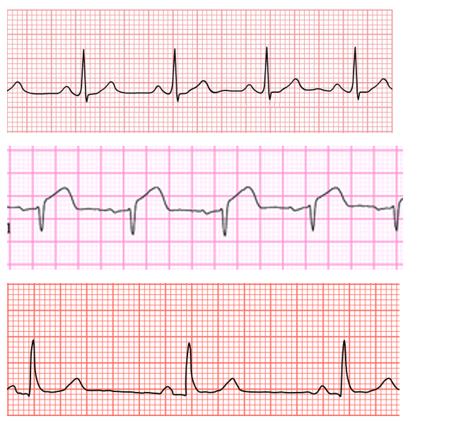 Solved 1. ﻿Why is it important for pacemaker cells to have | Chegg.com