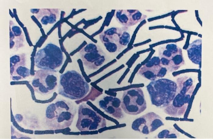 Solved identify organsim and cells seen in this gram stain | Chegg.com