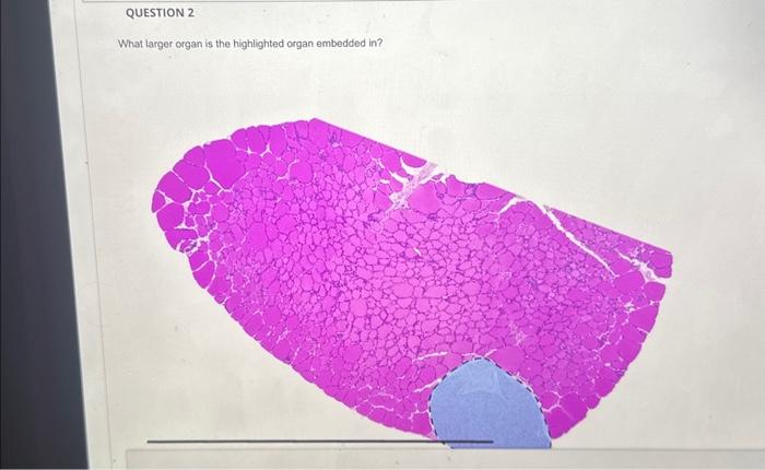 Solved What larger organ is the highlighted organ embedded | Chegg.com