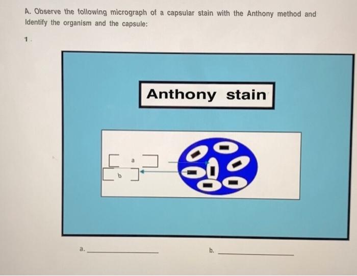 Solved A. Observe the following micrograph of a capsular | Chegg.com