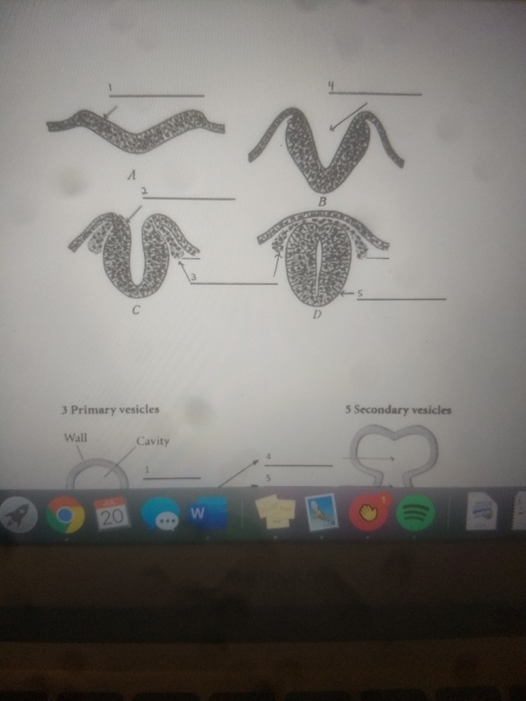 Solved 5 D 3 Primary vesicles 5 Secondary vesicles Wall | Chegg.com