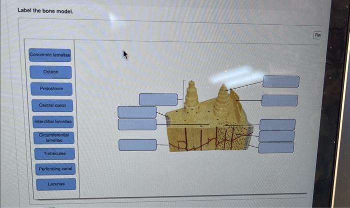 Solved Label the bone model. | Chegg.com