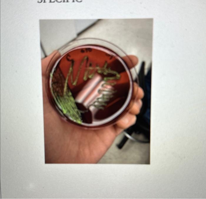 Solved shown below is an EMB plate. based on the procedure | Chegg.com