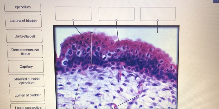 Solved Epithelium Lacuna Of Bladder Umbrella Cell Dense