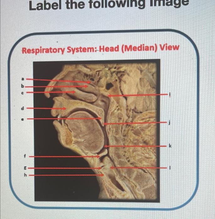 Solved Label the following Image Respiratory System: Head | Chegg.com