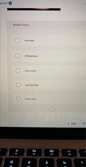Solved Which structure is highlighted? Multiple Choice | Chegg.com