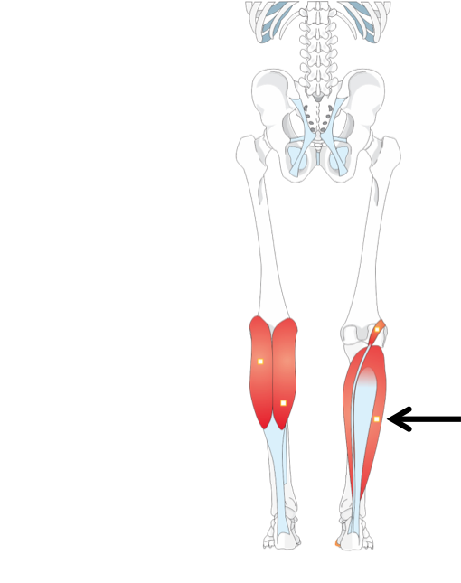 Solved the muscle indicated by the tip of the arrow in the | Chegg.com