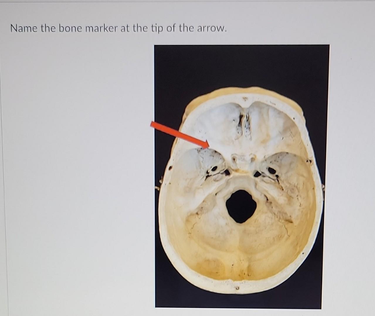 Solved Name the bone marker at the tip of the arrow. Name | Chegg.com