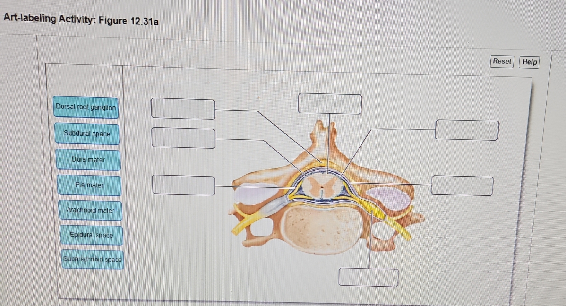 Solved Art-labeling Activity: Figure 12.31aResetHelp | Chegg.com