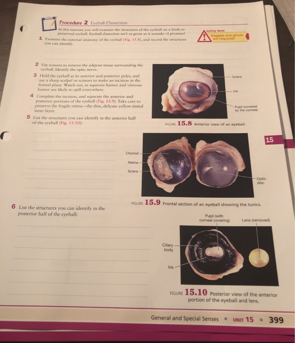 Solved Procedure 2 Eyeball Dissection In this exercise you | Chegg.com