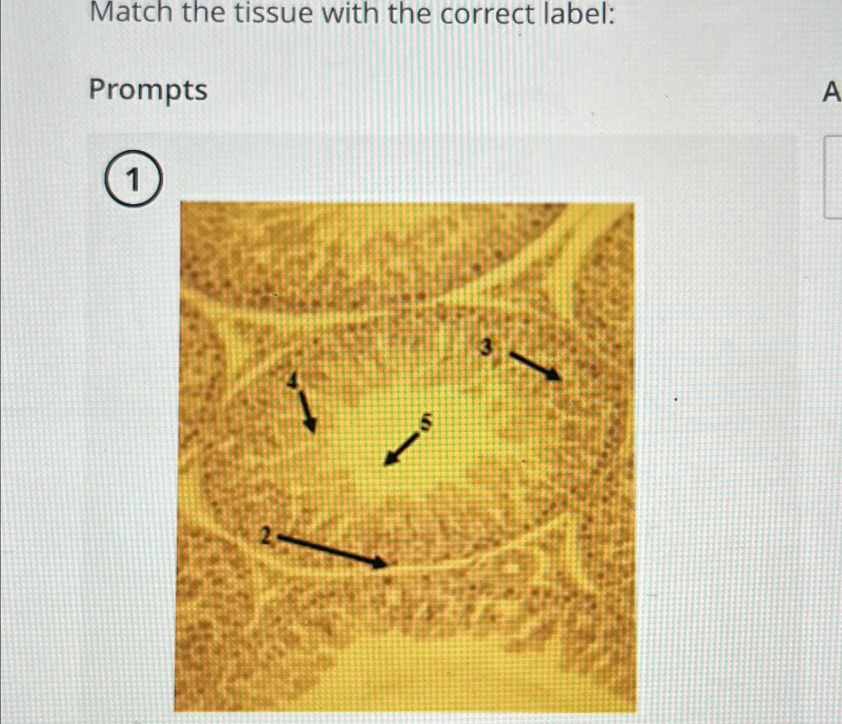 Solved Match the tissue with the correct label:Prompts | Chegg.com
