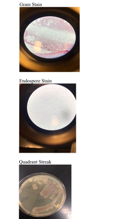 Solved Gram Stain Endospore Stain OCO Quadrant Streak | Chegg.com