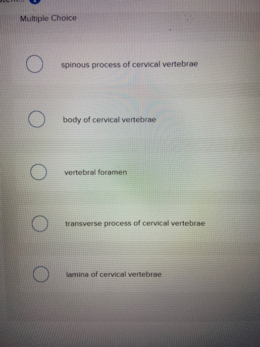 Solved Which structure is highlighted? Multiple Choice | Chegg.com