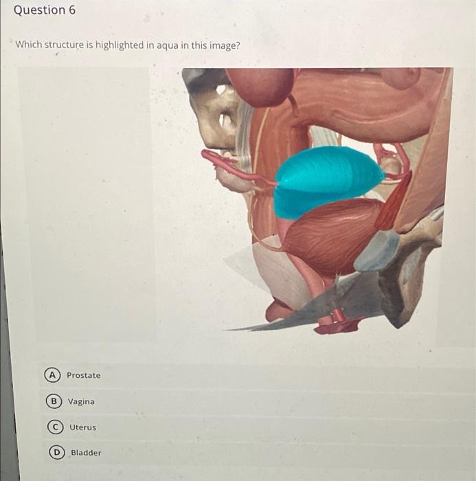 Solved Which structure is highlighted in aqua in this image? | Chegg.com