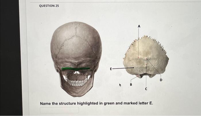QUESTION 18 Identify the structure highlighted in | Chegg.com