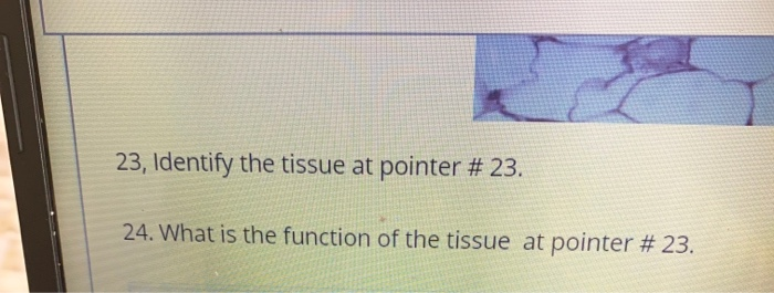 Solved QUESTION 6 21. Identify the tissue at pointer # 21. | Chegg.com