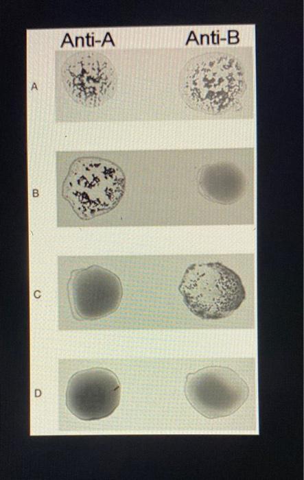 Solved Please answer question 21. it's a 4 step question. | Chegg.com