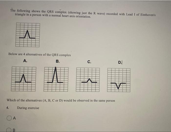 Solved The following shows the QRS complex (showing just the | Chegg.com