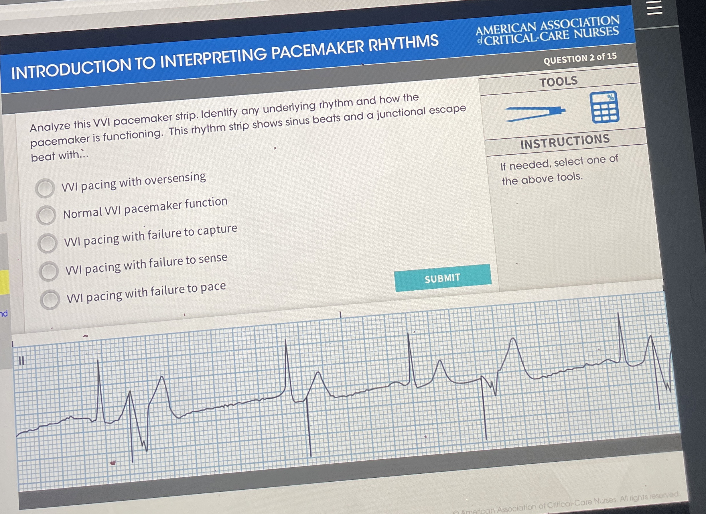 Solved INTRODUCTION TO INTERPRETING PACEMAKER | Chegg.com