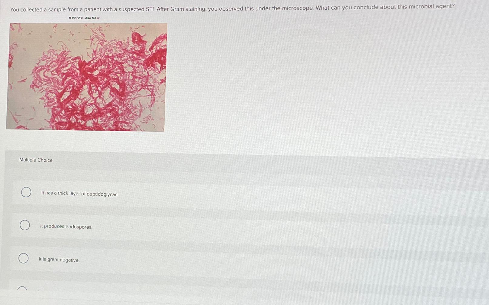 Solved You collected a sample from a patient with a | Chegg.com