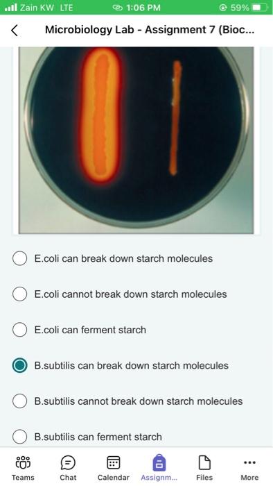 Solved Microbiology Lab - Assignment 7 (Bioc... E.coli can | Chegg.com