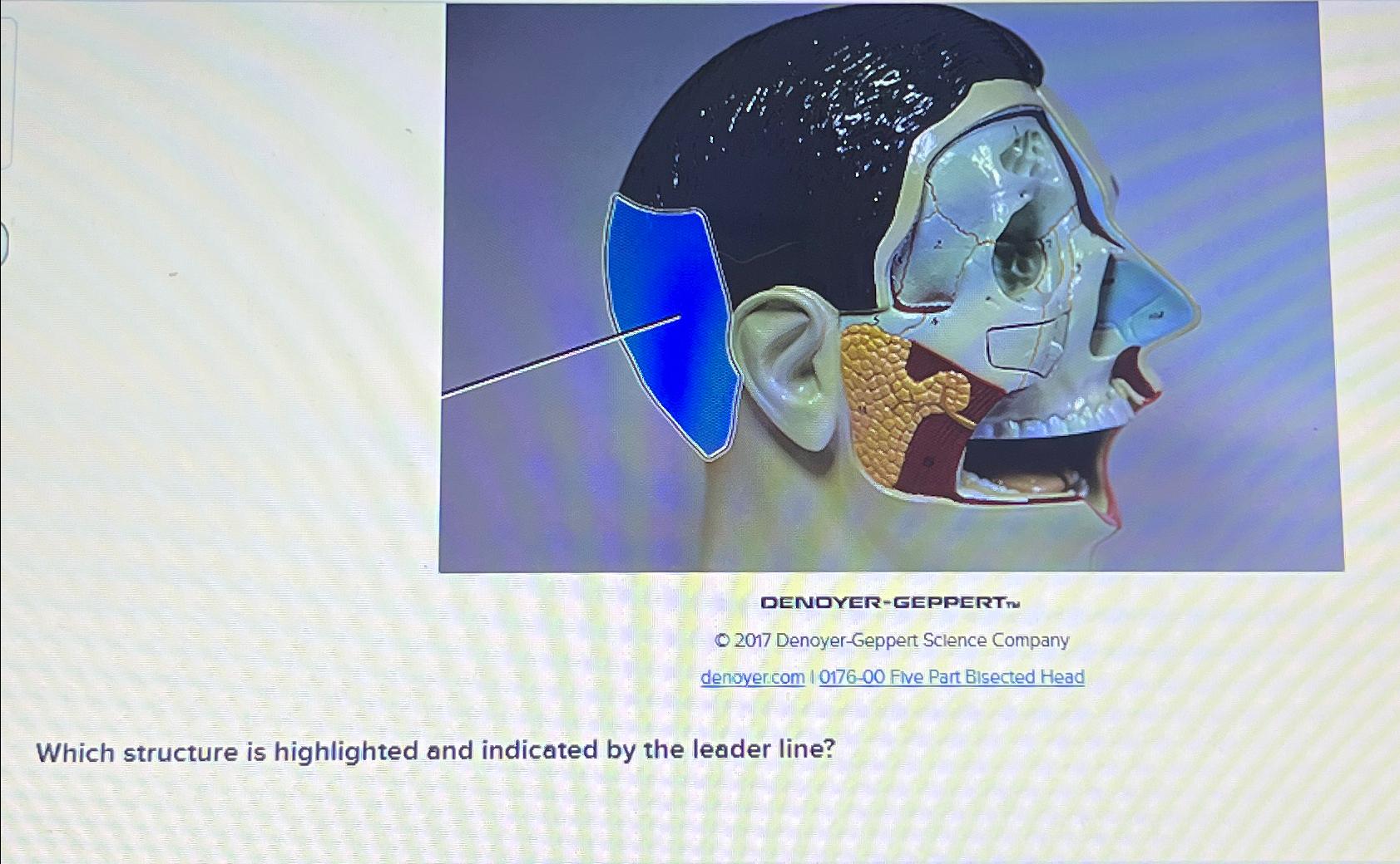 Solved DENDYER-GEPPERTTO 2017 ﻿Denoyer-Geppert Sclence | Chegg.com