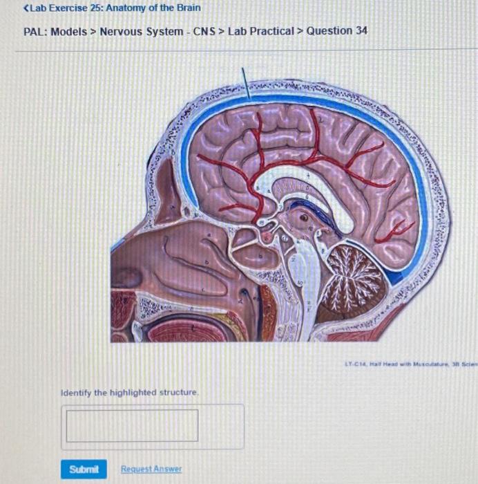 Solved Nervous System: CNS > Quiz > Question 19 Which | Chegg.com