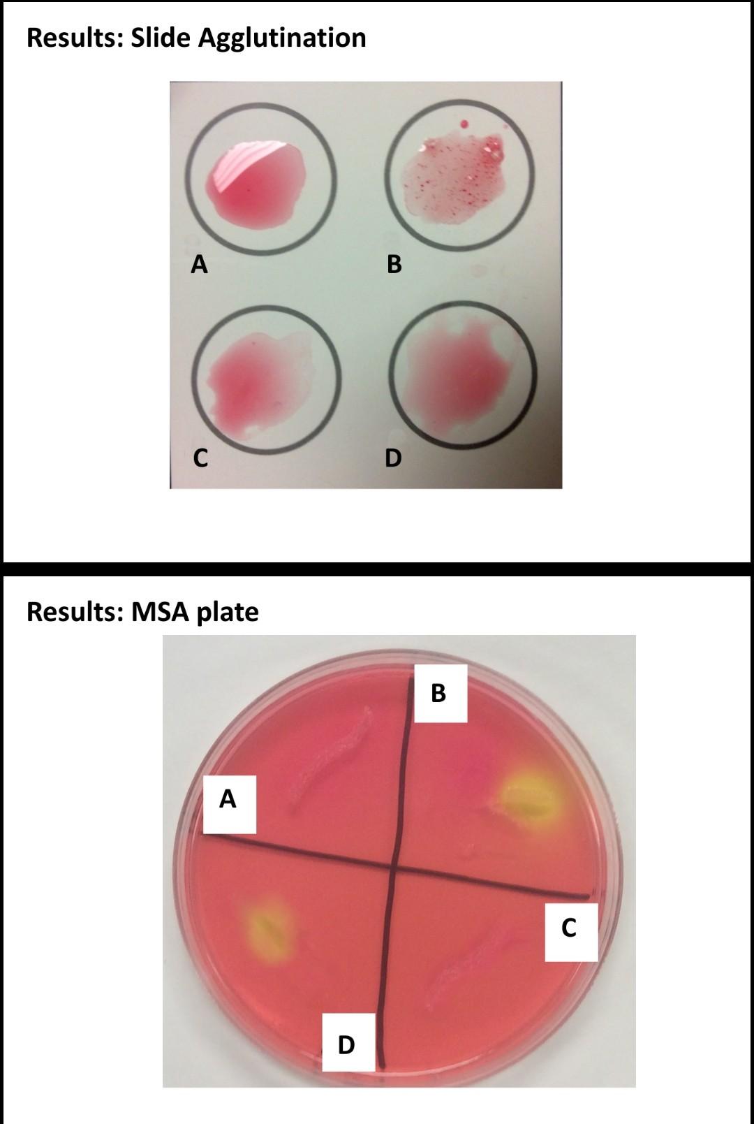 Solved Results: Slide Agglutination A B C D Results: MSA | Chegg.com