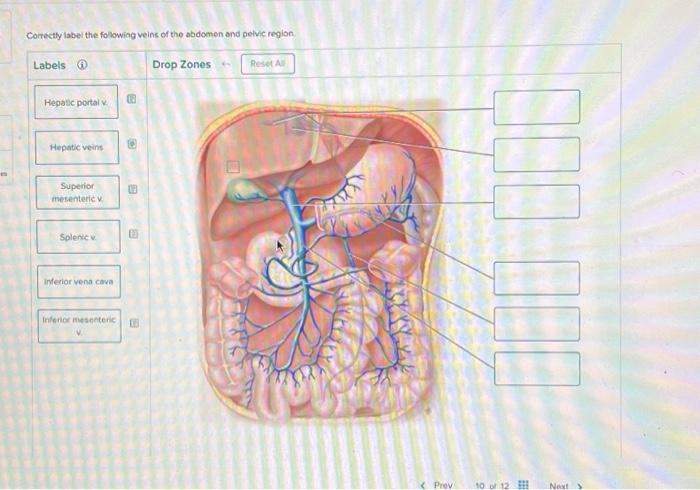 Solved Correctly label the following veins of the abdomen | Chegg.com