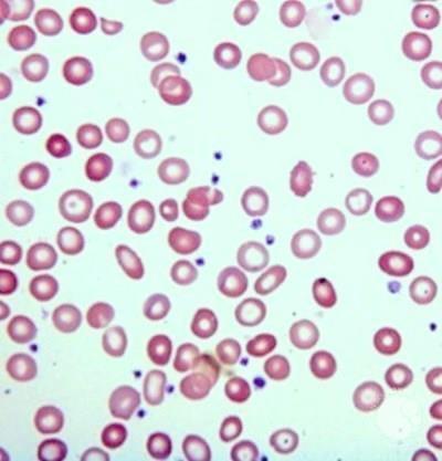 Solved find an image of a blood smear, study that image, and | Chegg.com