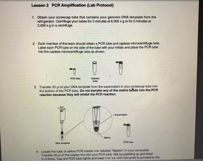 Solved Lesson 1 Cheek Cell DNA Template Preparation (Lab | Chegg.com