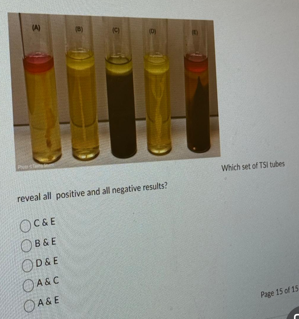 Solved Which set of TSI tubes reveal all positive and all | Chegg.com