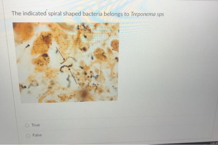 Solved Identify the flagella arrangement on this slide: A. | Chegg.com