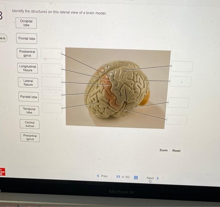 Solved Identify the structures on this midsagittal view of a | Chegg.com