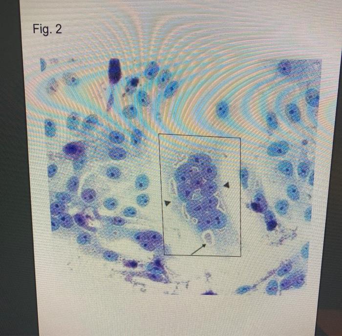 Solved QUESTION 2 Virus infection results in a number of | Chegg.com