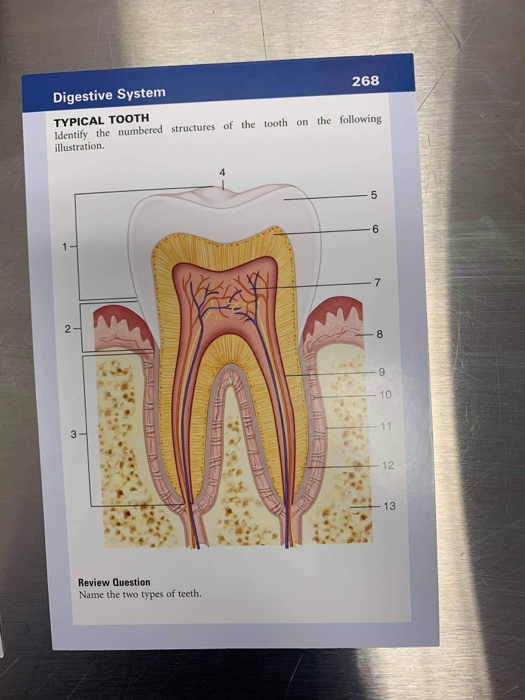 Solved Digestive System 268 TYPICAL TOOTH Identify the | Chegg.com