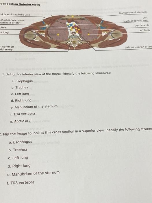 oss section (Inferior view) Manubrium of sternum sht | Chegg.com