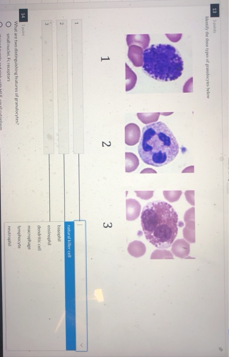 Solved 13 Identify the three types of granulocytes below 1 2 | Chegg.com