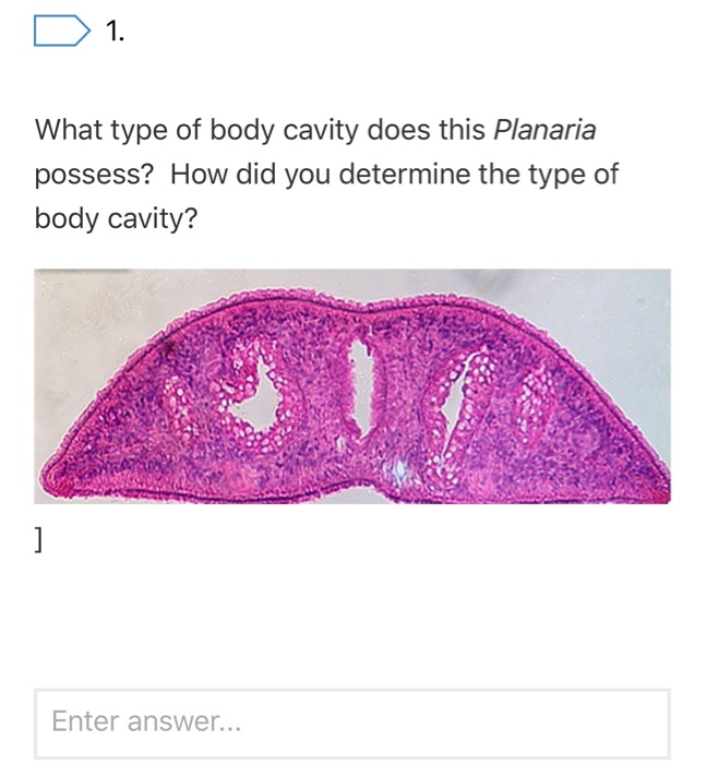 Solved D1. What type of body cavity does this Planaria | Chegg.com