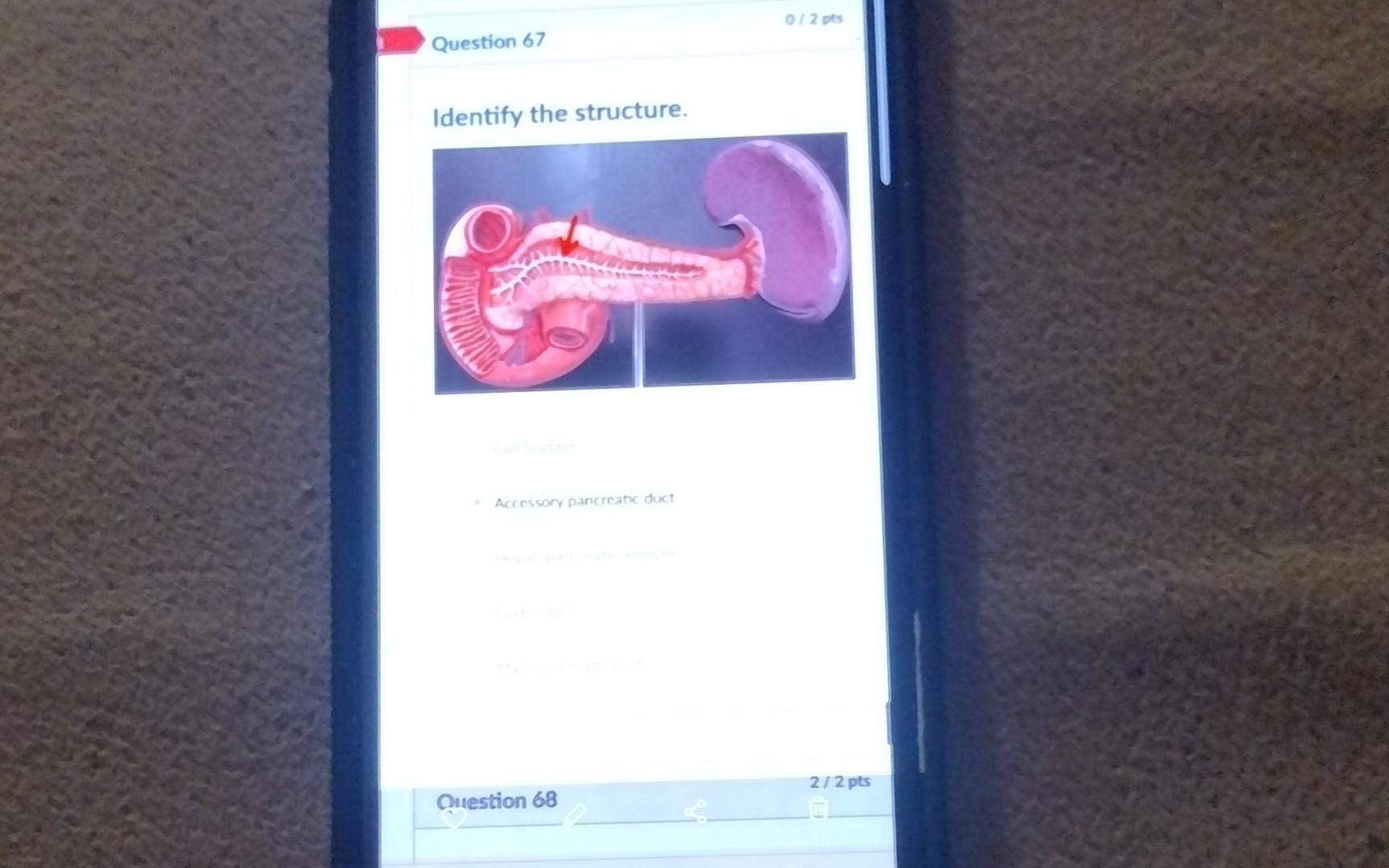 Name the anatomical feature. Ventral root Ventral | Chegg.com