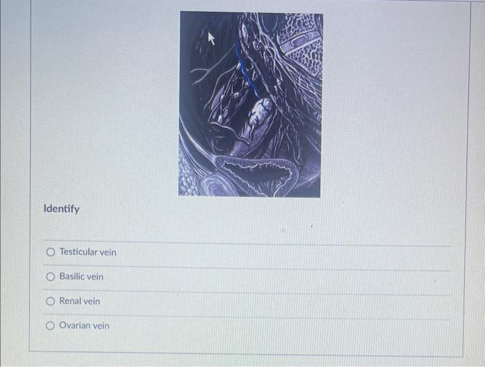 Solved Identify Testicular vein Basilic vein Renal vein | Chegg.com
