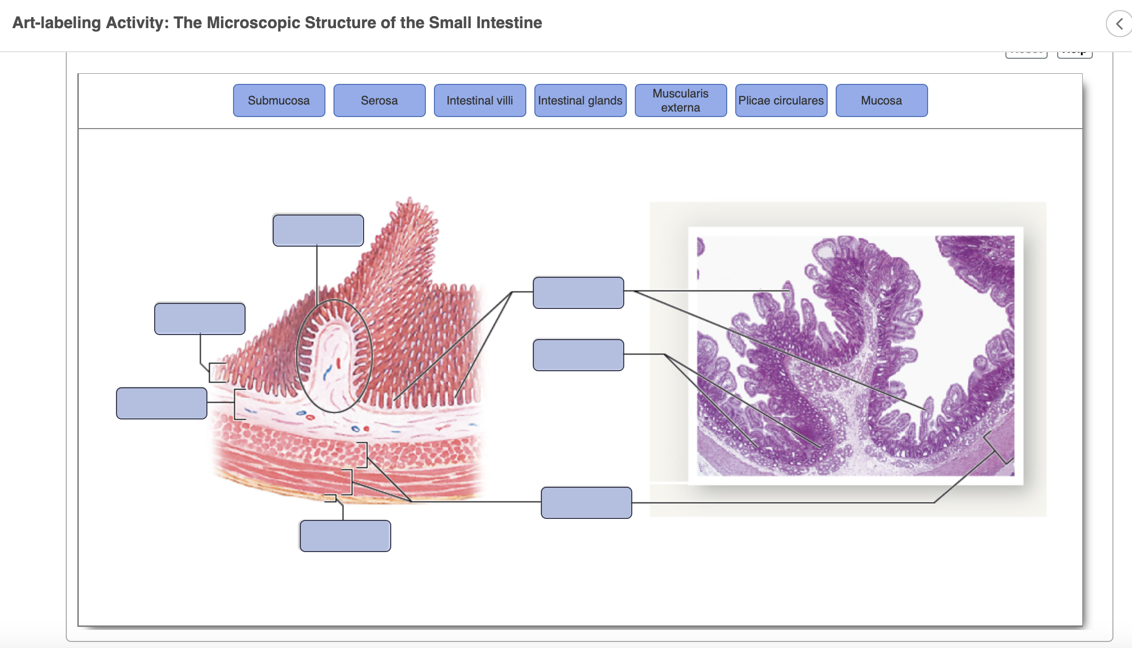 Solved Art-labeling Activity: The Microscopic Structure of | Chegg.com