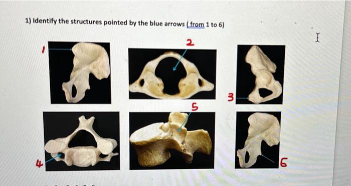 Solved 1) Identify the structures pointed by the blue arrows | Chegg.com Solved 1) Identify the structures pointed by the blue arrows | Chegg.com