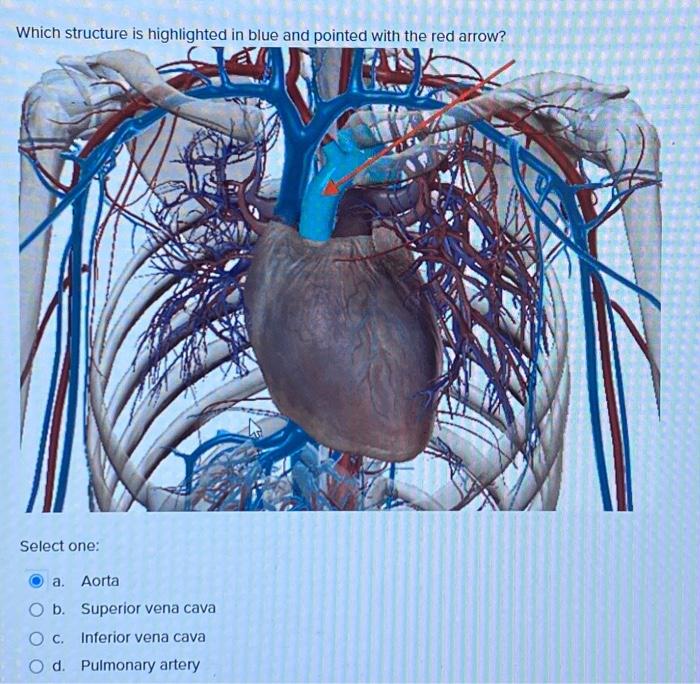 Solved Select one: a. Aorta b. Superior vena cava C. | Chegg.com