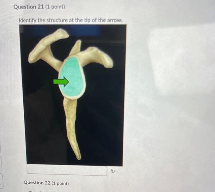 Solved Question 15 (1 point) Identify the highlighted | Chegg.com