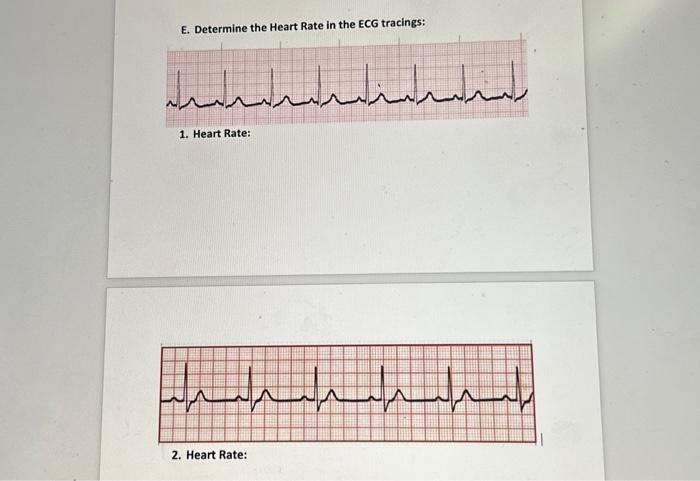 E. Determine the Heart Rate in the ECG tracings: 1. | Chegg.com