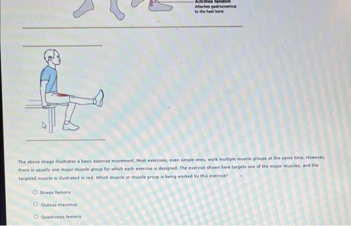 Solved Back to Assignment Attempts Average/3 1. Skeletal | Chegg.com